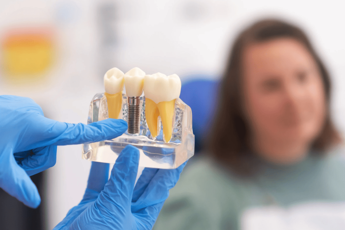 Comprehensive Guide to Dental Implants: From Candidacy to Long-Term ...