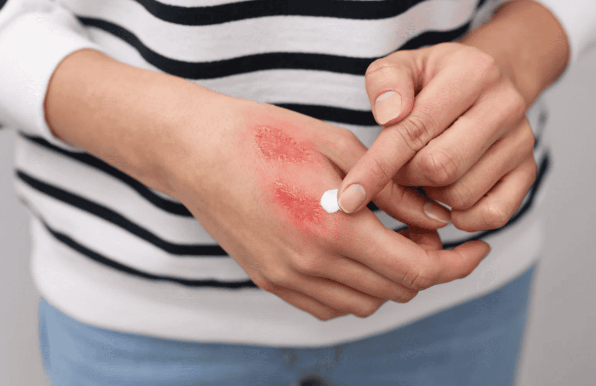 Understanding the Body’s Healing Mechanisms for Faster Recovery