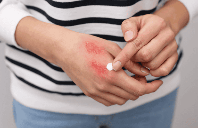 Understanding the Body’s Healing Mechanisms for Faster Recovery