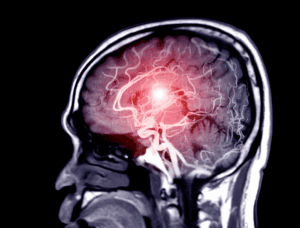 Understanding the Types of Solid Tumors in Oncology Practice