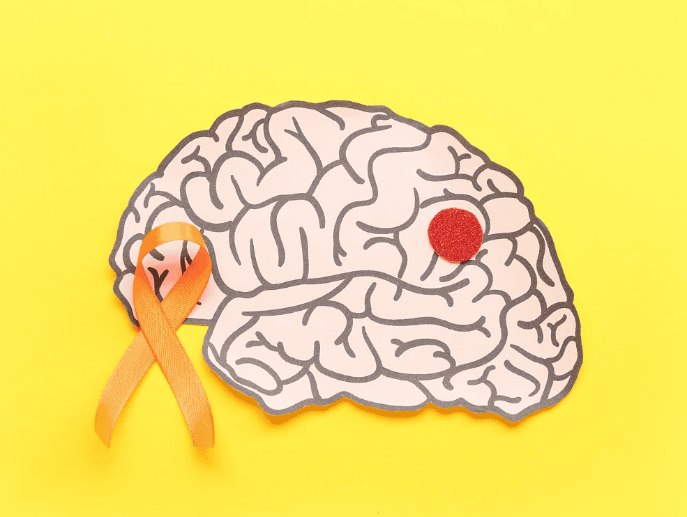 Coping with the Uncertainty of Multiple Sclerosis