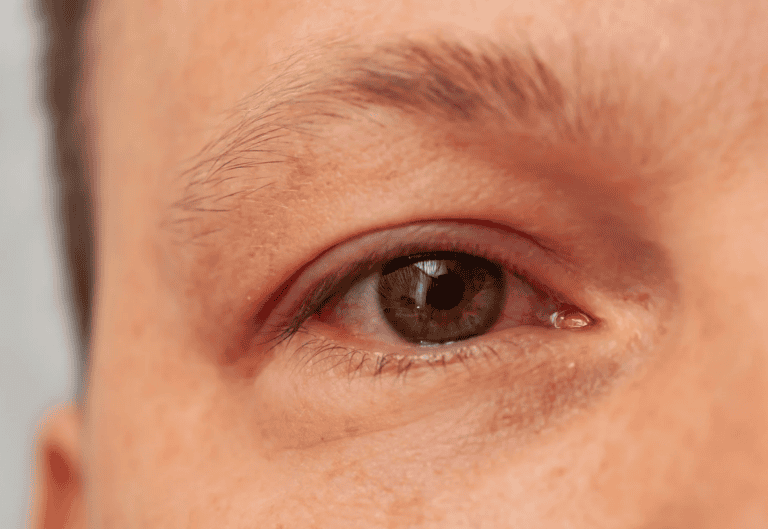 Altus Emergency Care Guide - What Causes Swelling Under Eye?